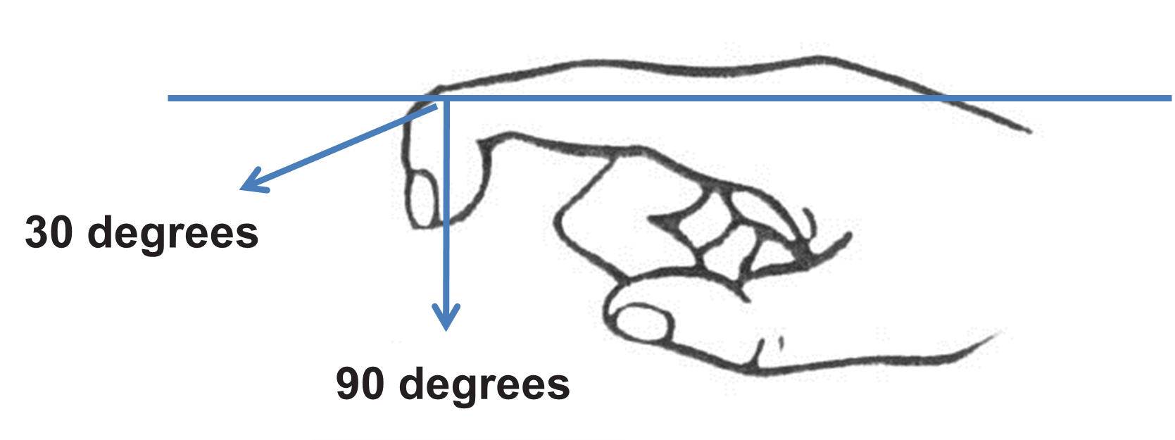 Mallet Finger - Gateshead Health