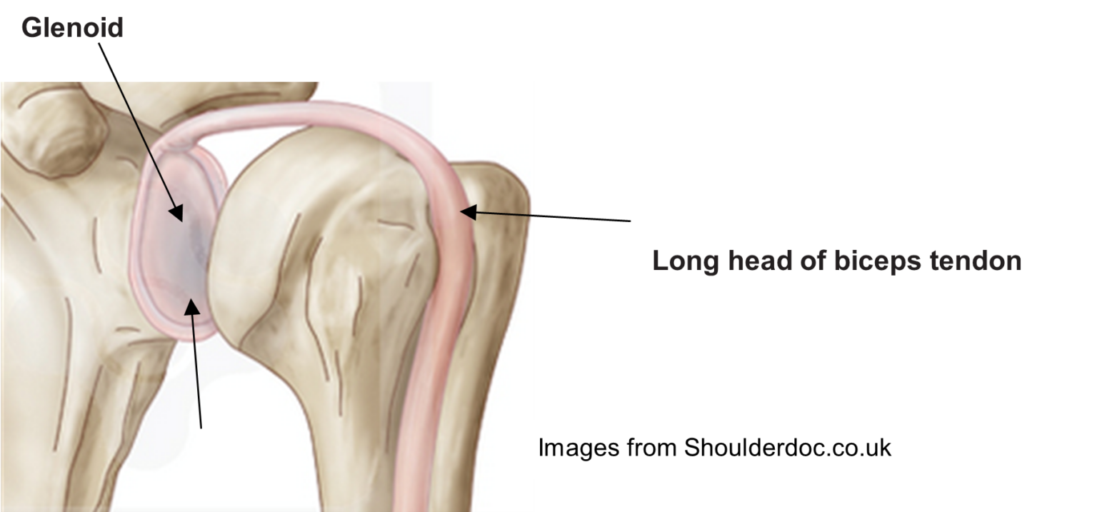 Shoulder Stabilisation Surgery - Gateshead Health